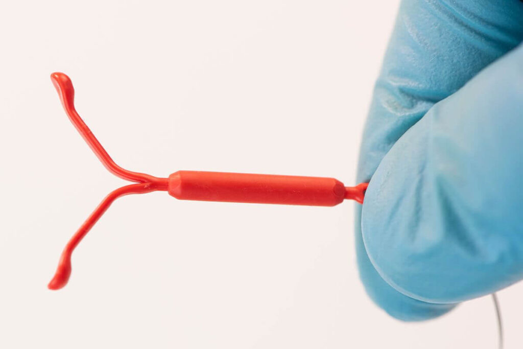 Taking a Bath After IUD Insertion: What You Need to Know